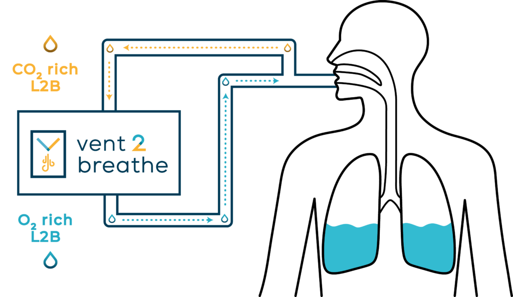 Total Liquid Ventilation Technology – Orixha